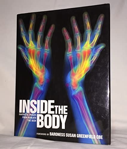 Photographic Atlas Of The Body Pictures Supplied By The Science Photo
