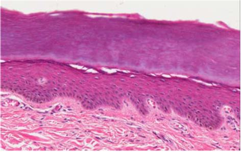 Histology Appendix 2 Staining Techniques Flashcards Quizlet