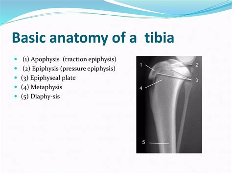 Basic Anatomy Of A Tibia Pptx