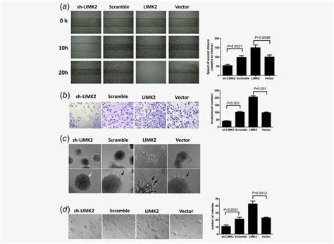Effect Of Limk2 Expression Level On Um Uc 3 Bladder Cancer Cell