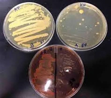 Microbiology Lab Testing Services At Sample In Ghaziabad ID