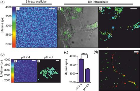 Protein Aggregation Microscopy At Alyssa Corrie Blog