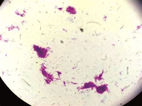 Acid Fast Staining Of Map Bacilli Download Scientific Diagram
