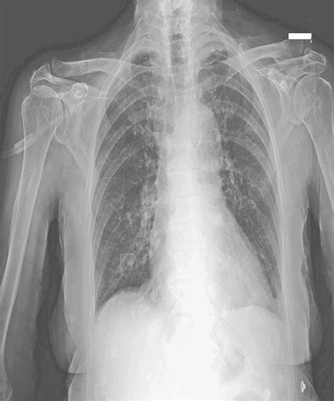 Python Detect If An Image Is Negative Stack Overflow