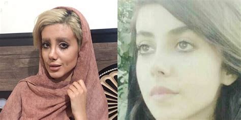 Irans ‘zombie Angelina Jolie Reveals Her Real Face Before Plastic Surgery