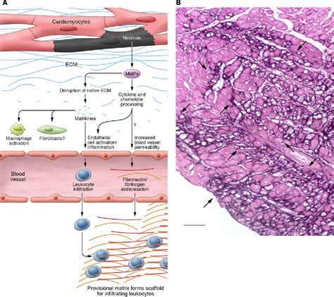 Figure 1 From The Extracellular Matrix In Myocardial Injury Repair