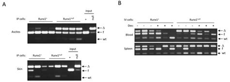addiction to runx1 is partially attenuated by loss of p53 in the eµ myc
