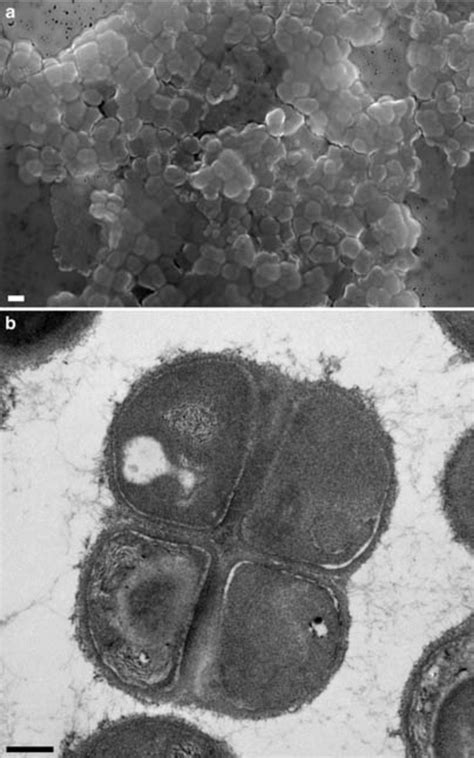 Micrococcus Luteus Negative Stain