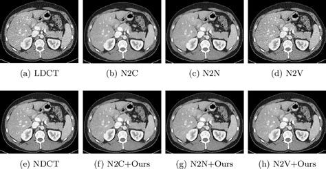 figure 3 from self supervised learning based ct denoising using pseudo