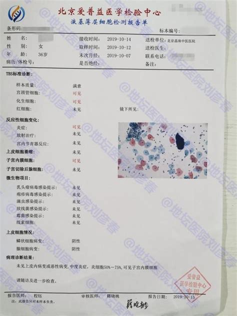 Cin3级累腺，不锥切还能怎么样？其实，刀下留“宫颈”同样也能痊愈 微医（挂号网）