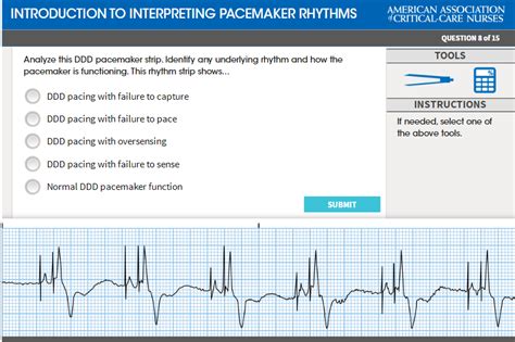 Solved Analyze This Ddd Pacemaker Strip Identify Any Chegg