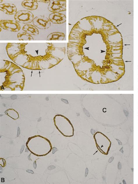 Intercalated Cell Of Collecting Duct Of Renal Tubule Semantic Scholar