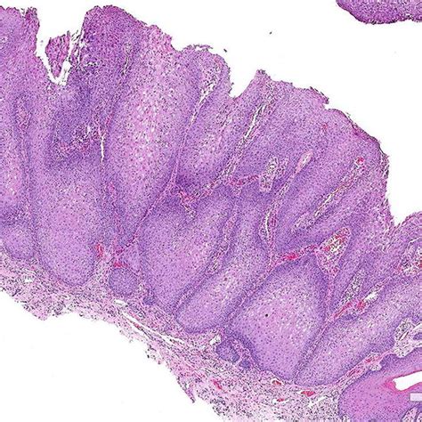 A B Low And High Magnification Photomicrographs Of Pas Staining C D