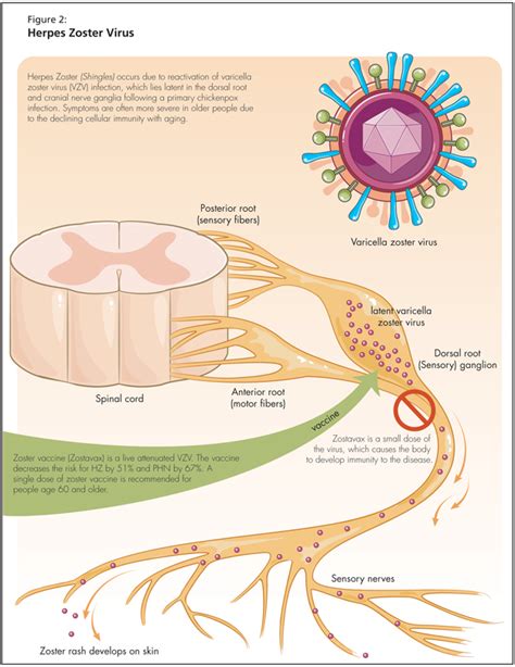 1107vaccinefig2 HealthPlexus Net