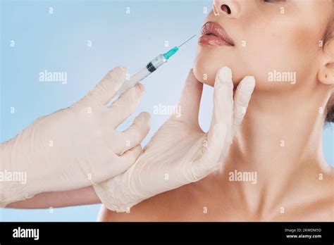 Botox Plastic Surgery And Filler With The Lips Of Woman Getting An