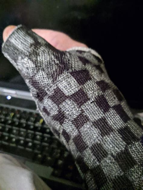 Scaphoid Fracture Cast Fingerless It Cast Arm Warmers