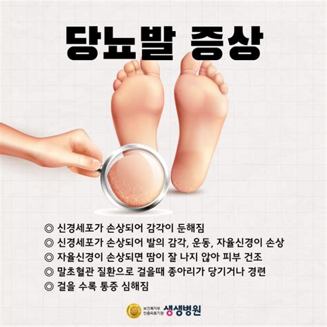 당뇨발 당뇨 발가락 발톱 상처 관리의 중요성과 치료 방법 네이버 블로그