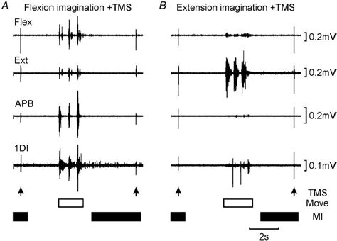 The Journal Of Physiology On Linkedin Induction Of Plasticity In The