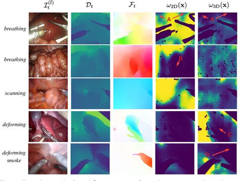 Learning How To Robustly Estimate Camera Pose In Endoscopic Videos