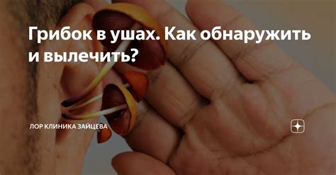 Грибок в ушах Как обнаружить и вылечить ЛОР КЛИНИКА ЗАЙЦЕВА Дзен