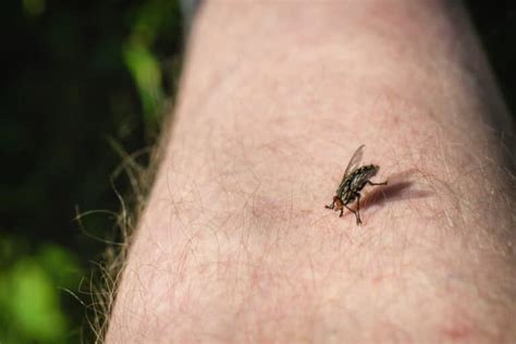 Gnat Bites On Humans Symptoms And Relief Tips Nextgen