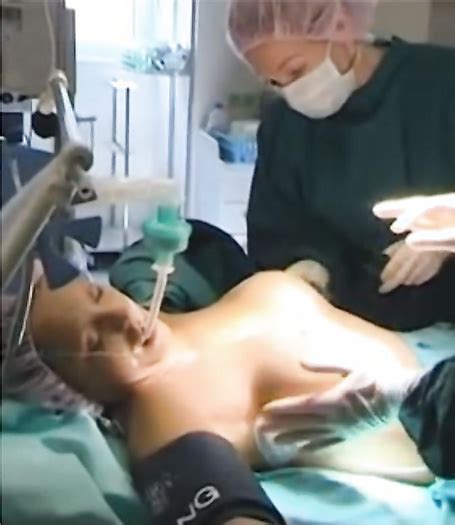 Intubation Image 4125175 Thisvid Tube