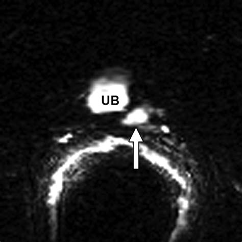 Use Of Maximum Slope Images Generated From Dynamic Contrast Enhanced