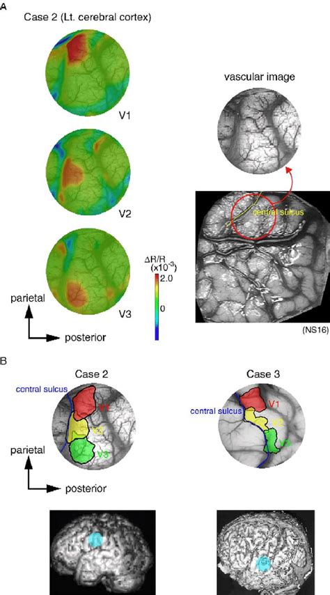 Intrinsic Optical Images And Maps Of The Face Region In The