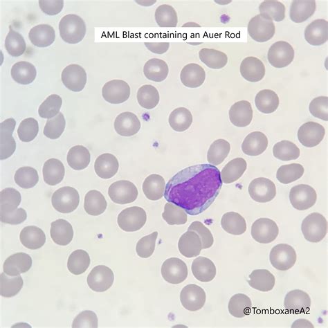 Peripheral Blood — Haembase