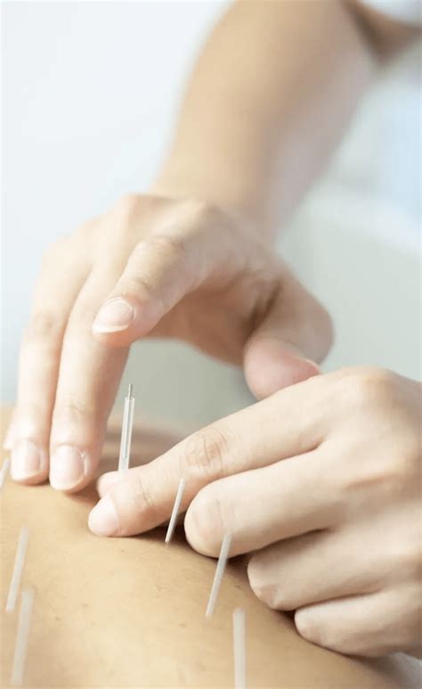 Acupuncture Womens Healthcare Group Of Illinois