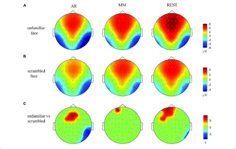 Voltage Topographies And Spsm Of N170 Peaks A Voltage Topographies
