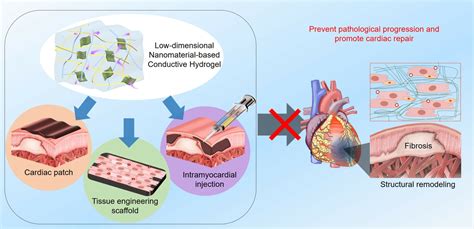 Electrically Conductive Hydrogels For Cardiac Tissue Repair Ijn