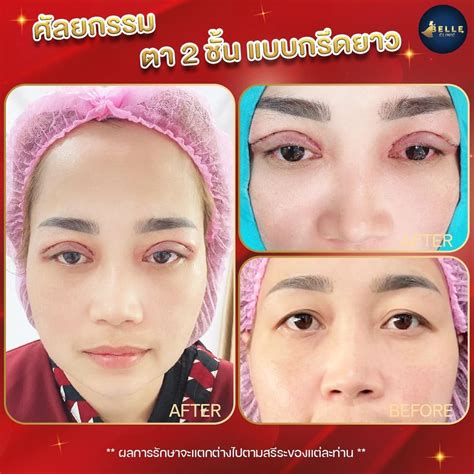 กราบความสวย Belle Clinic เบลล์คลีนิกเวชกรรม เพจหลัก