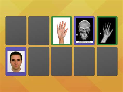 X Ray And Body Parts Matching Pairs