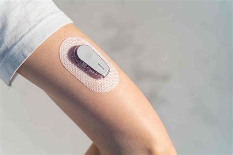 Breaking Fda Clears Dexcom Stelo First Otc Continuous Glucose Monitor