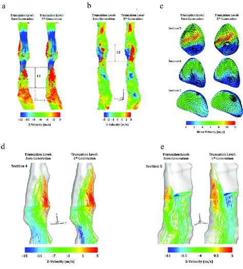 Tracheal Streamlines Colored A The Z Component B The U Component Of Download Scientific