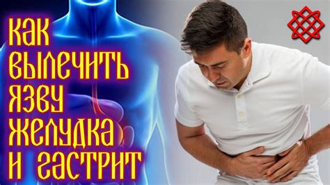 ЛЕЧЕНИЕ ЯЗВЫ ЖЕЛУДКА НАРОДНЫМИ СРЕДСТВАМИ Как Вылечить Язву Желудка и