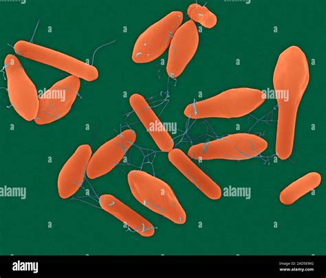 Coloured Scanning Electron Micrograph Sem Of Clostridium Botulinum