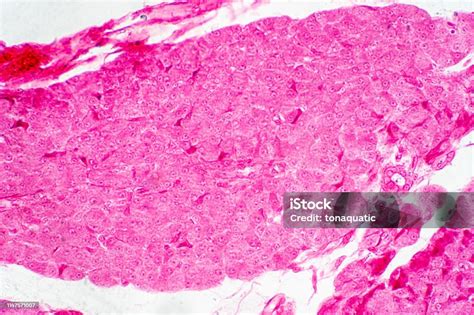 Jaringan Hati Manusia Di Bawah Pandangan Mikroskop Untuk Histologi