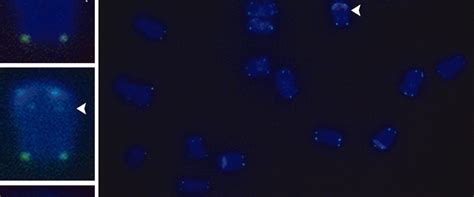 Understanding Truncation And Wildcard Search Techniques