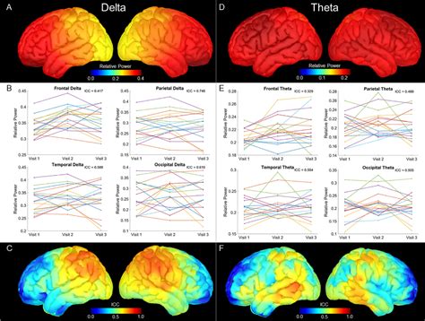 Figure 1 From Three Year Reliability Of Meg Resting State Oscillatory