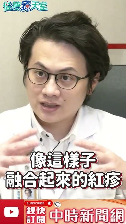 蕁麻疹找不到原因？ 醫揭5大誘因揪出過敏兇手 Chinatimes Shorts Youtube