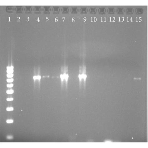 Pcr Amplified 745 Bp Dna Bands Using Coi Primers To Identify Culex Download Scientific Diagram