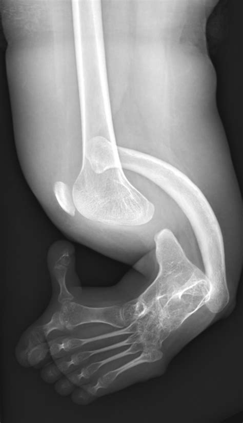 Image Radiopaedia Org