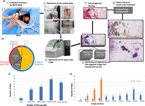 Figure 1 From Deep Learning Using Endobronchial Ultrasound Guided