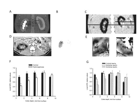 Biomolecule Complexes As Contrast Agents In Positron Emission