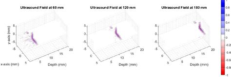 Figure 1 From 3 D Super Resolution Ultrasound Imaging Using A 2 D