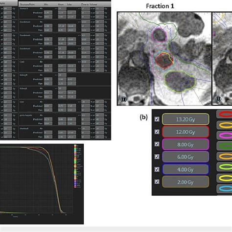Representative Adaptive Fractions A Prediction Of Dose From The Download Scientific Diagram