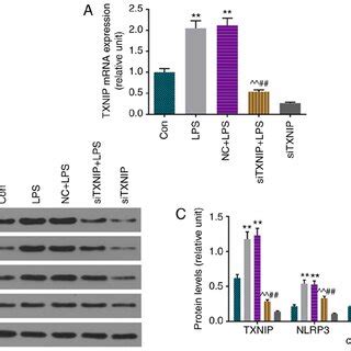 Protein Levels Of Cleaved Caspase 1 Are Upregulated And TXNIP And NLRP3