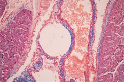 Histological Pancreas Human Liver Human Vermiform Appendix Human And